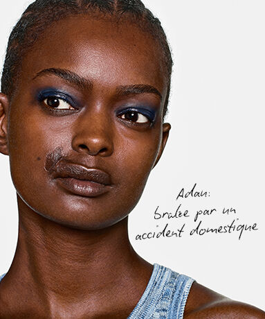 skin-life-changers