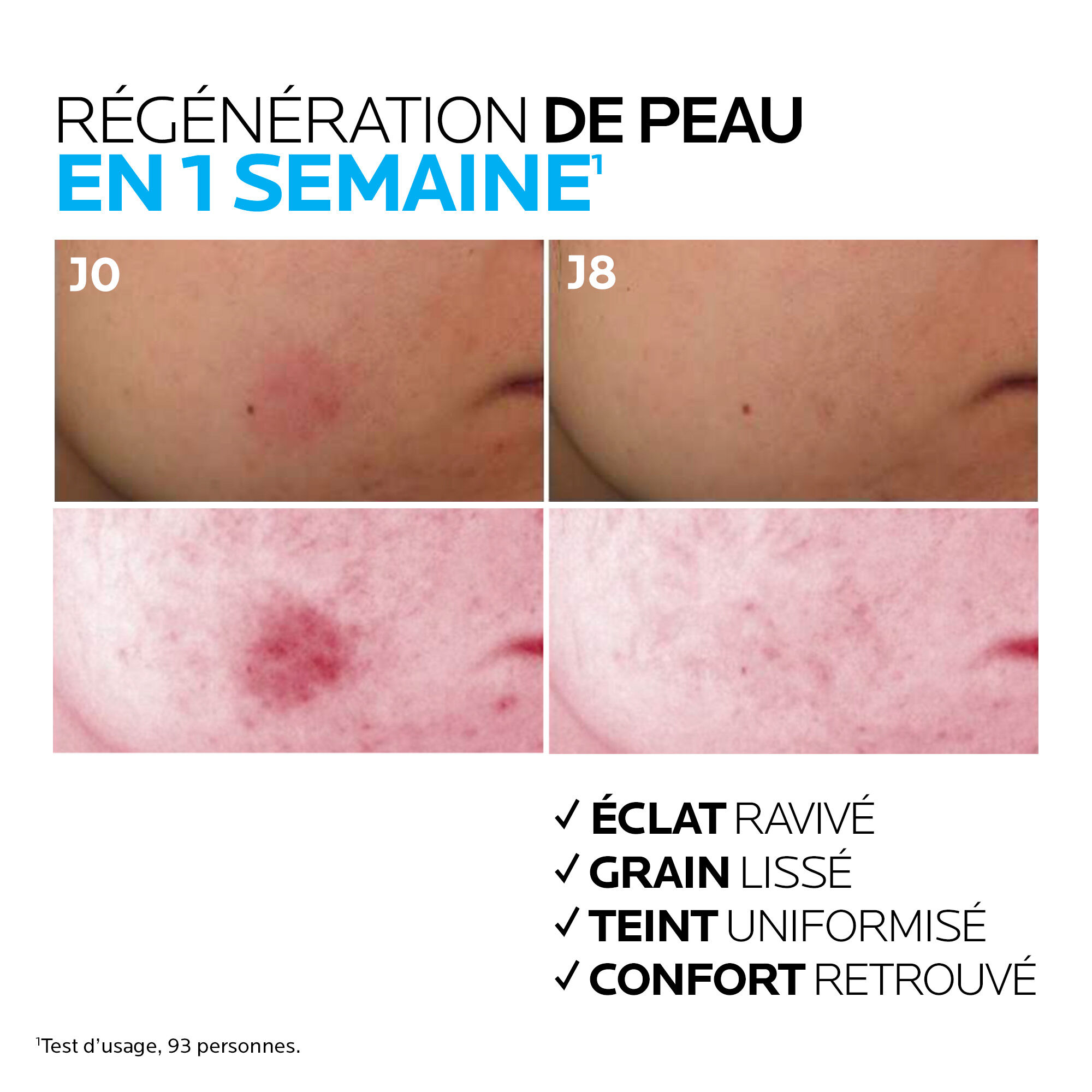 Cicaplast B5 sérum à la Vitamine B5 Ultra-concentré | La Roche-Posay